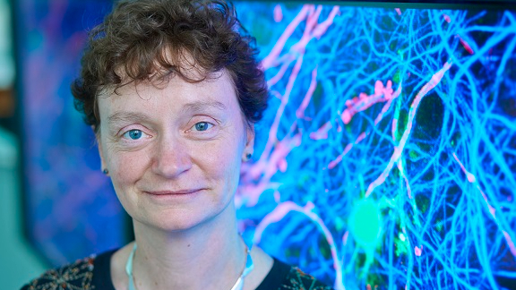 Professor Anna Williams | MS Society