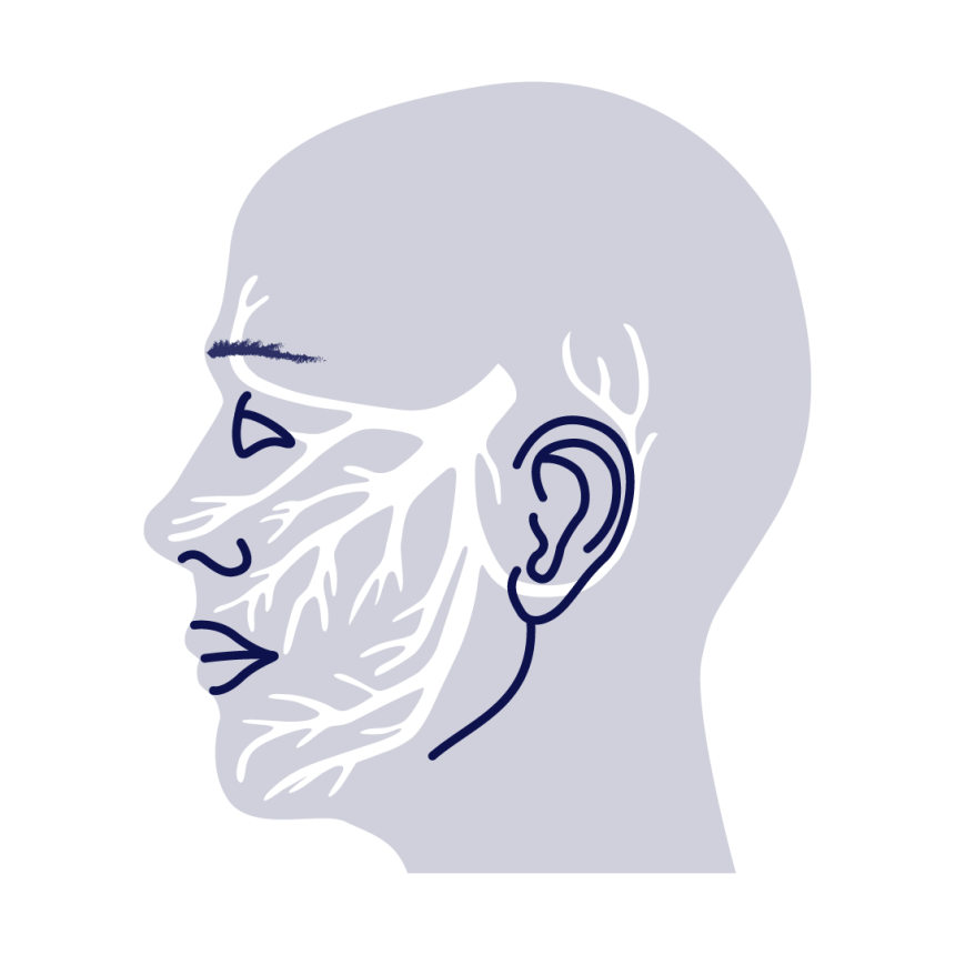 Trigeminal neuralgia and MS | MS Society