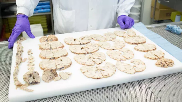 “You could think of it as their legacy to science” | MS Society